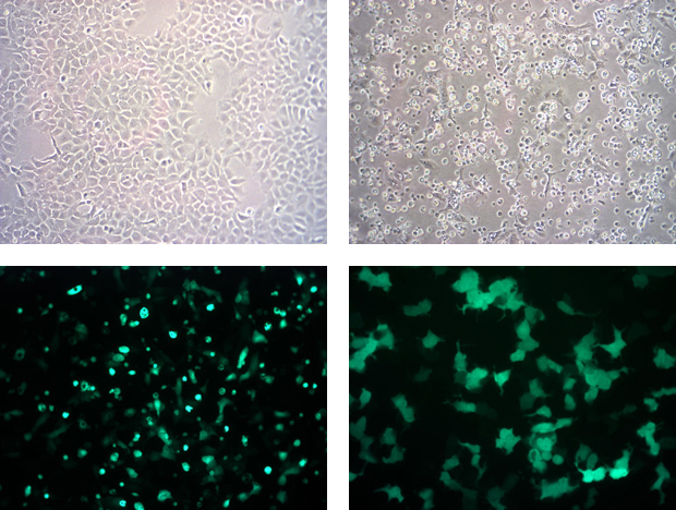 AAV-2 Packaging System